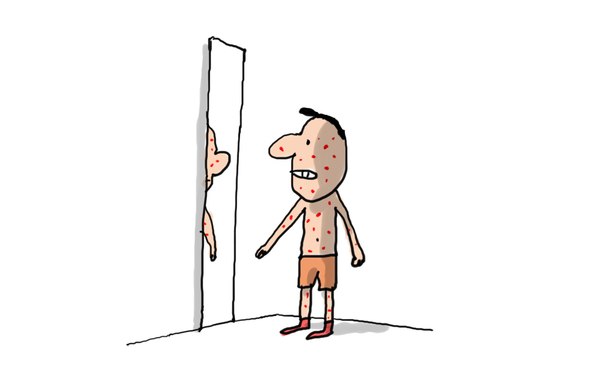 C'est quoi la rougeole